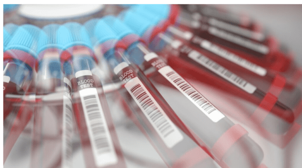 Sepsis 2 – Association for Integrity in Healthcare Documentation